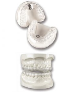 Sleep Apnea - ProtoDental